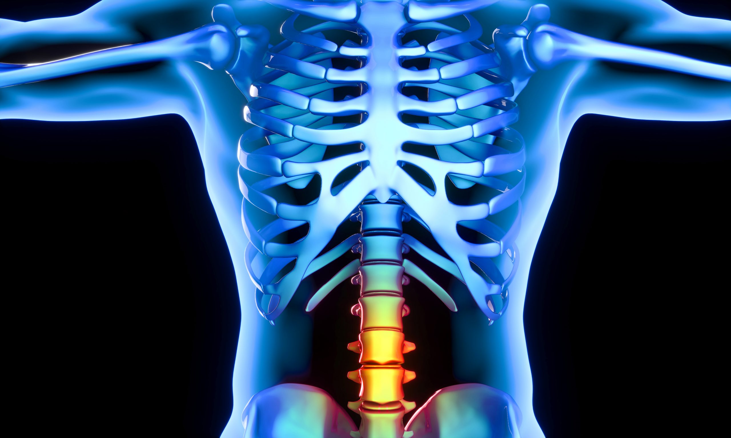 Hernia Discal Lumbar Cu ndo Es Motivo Suficiente Para Operarse Hernia Discal Lumbar Cu ndo Es Motivo Suficiente Para Operarse